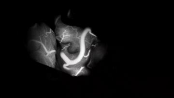 KINEVO 900 S Campaign Page