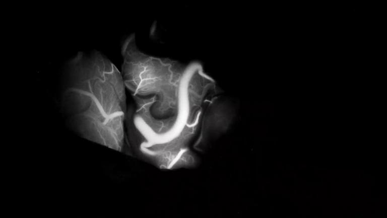 KINEVO 900 S Campaign Page